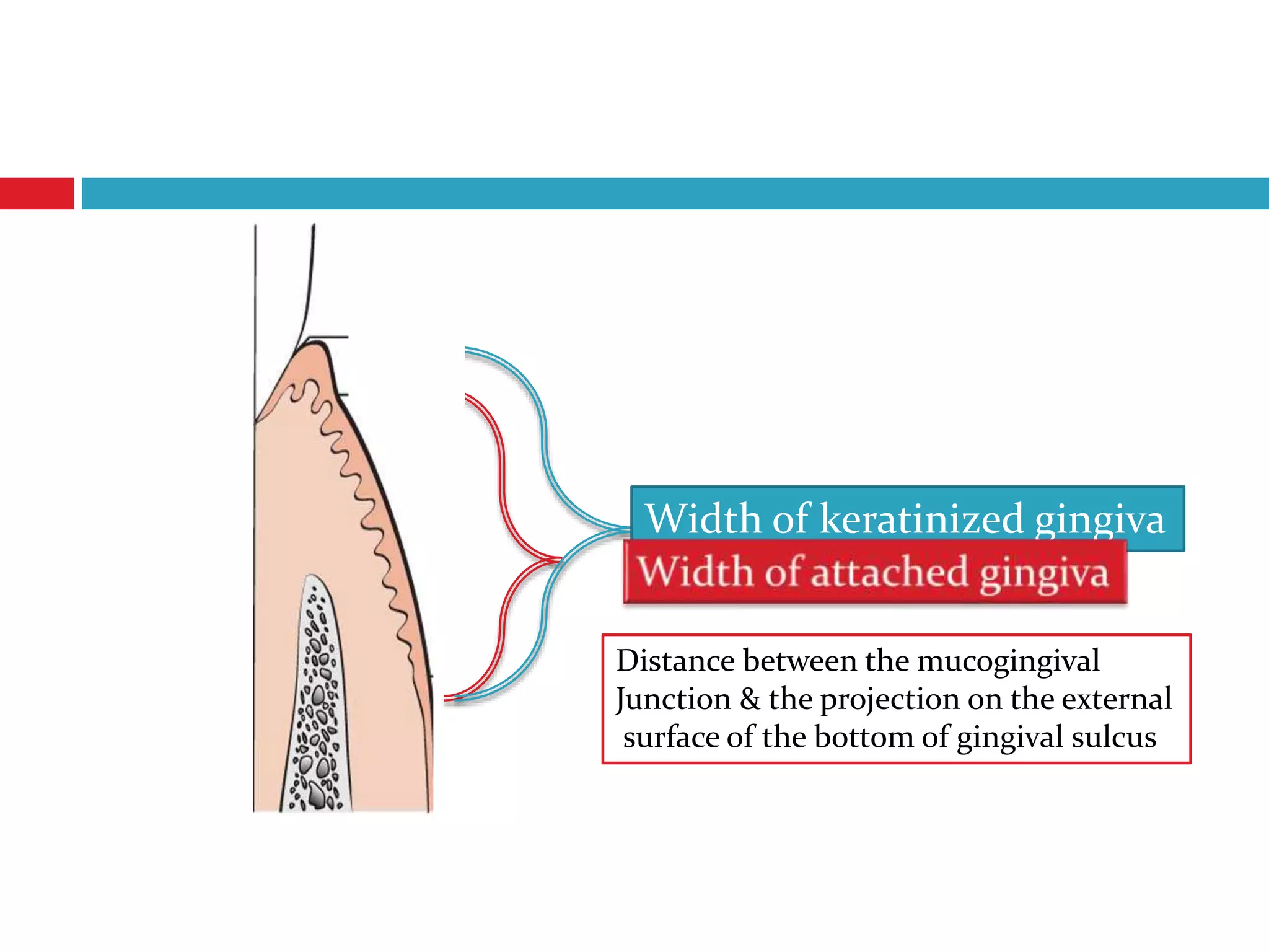 gingiva | PPTX