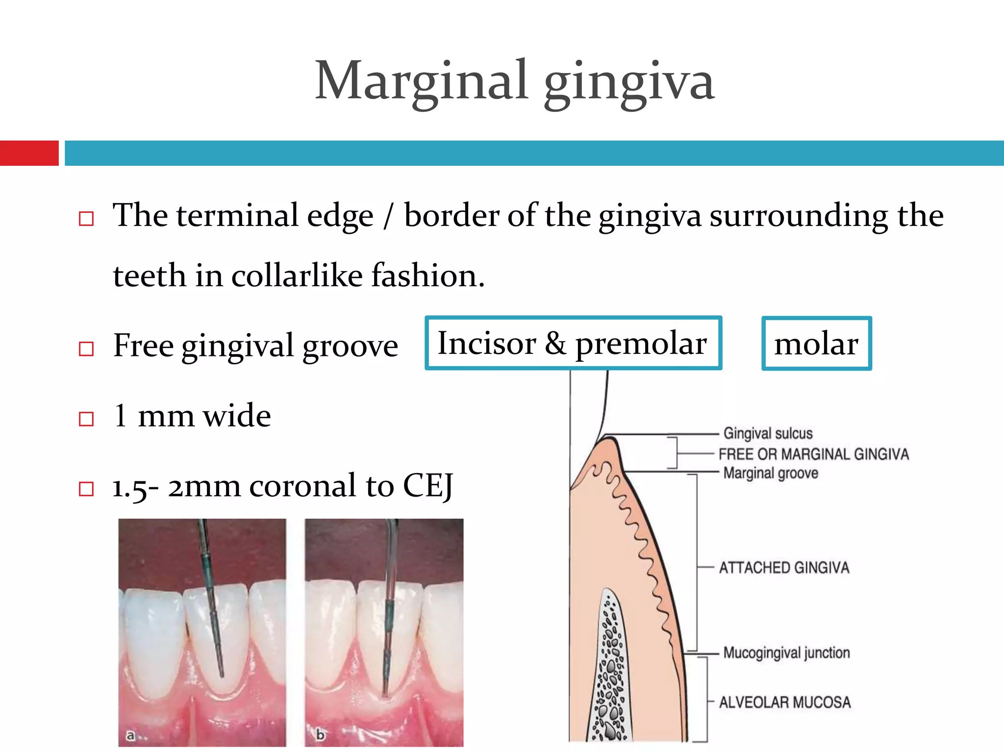 gingiva | PPTX