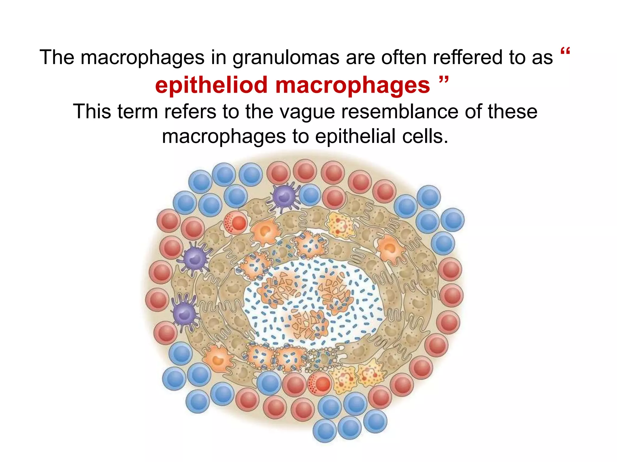 Granulomatous diseases of the nose | PPT