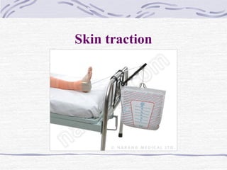 Fractures.ppt first aid first sem bsc nursing | PPT