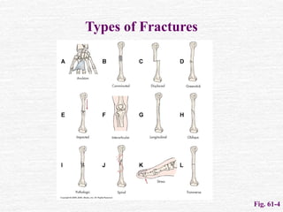 Fractures.ppt first aid first sem bsc nursing | PPT