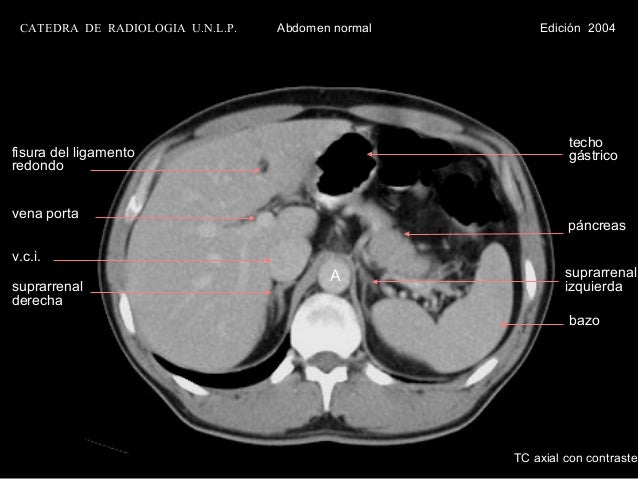 4 imagenes normales abdomen_ (1)