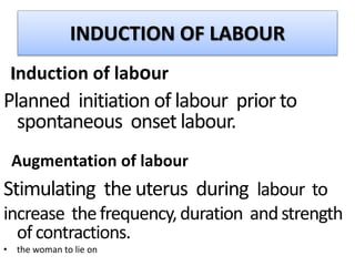 4 Induction of labour.pptx