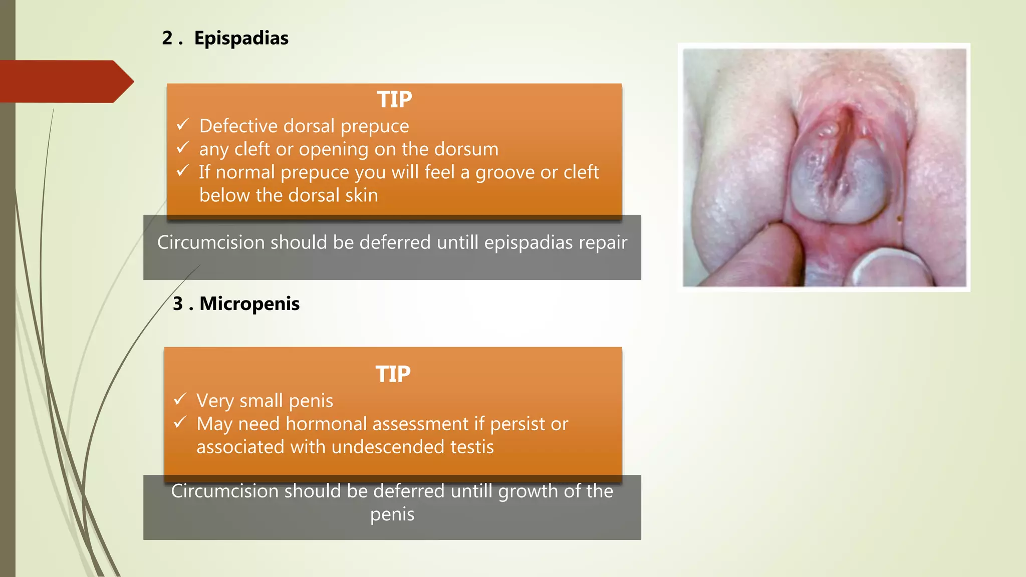 Pediatric Circumcision lecture | PPTX