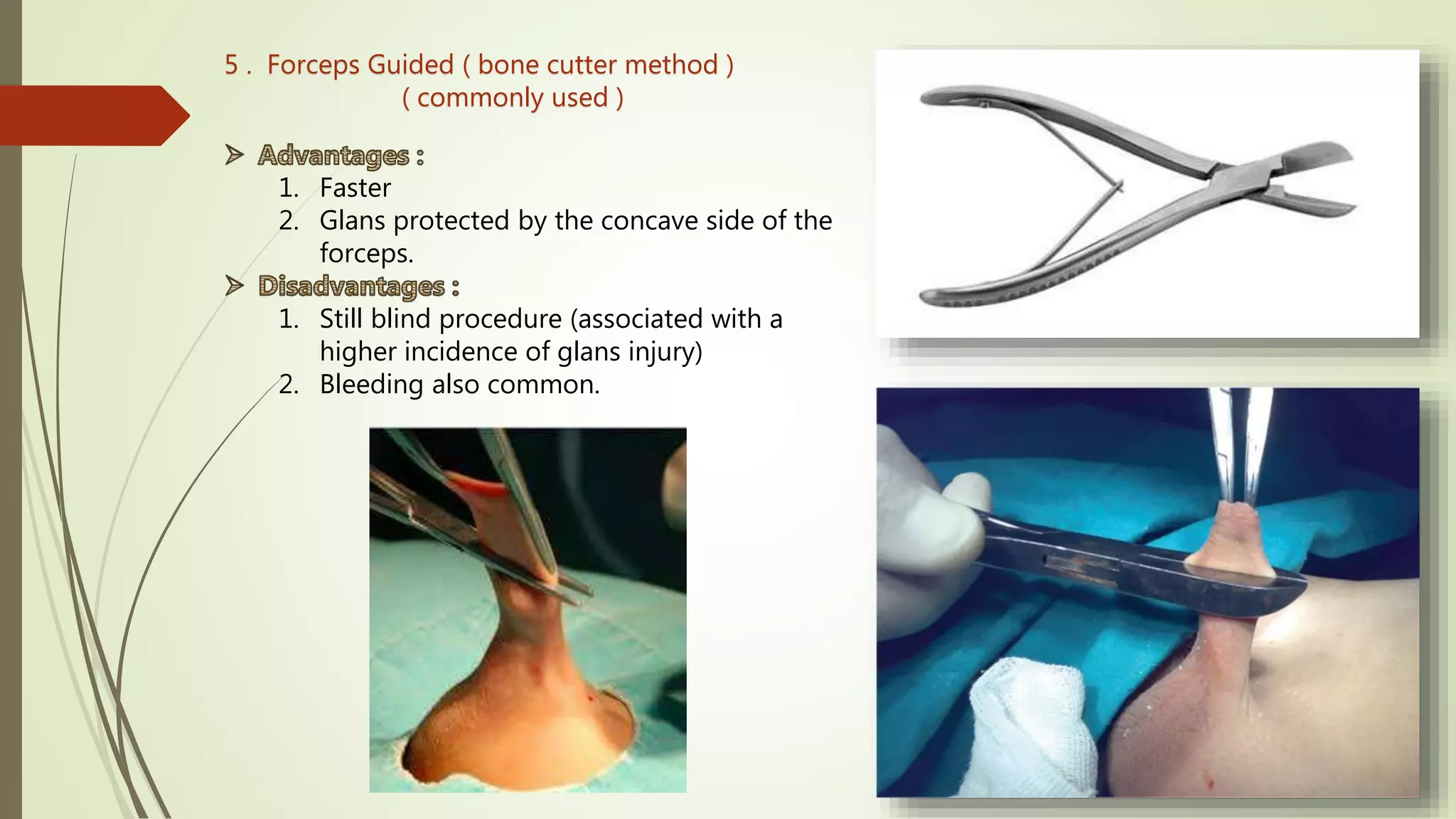 Pediatric Circumcision lecture | PPTX
