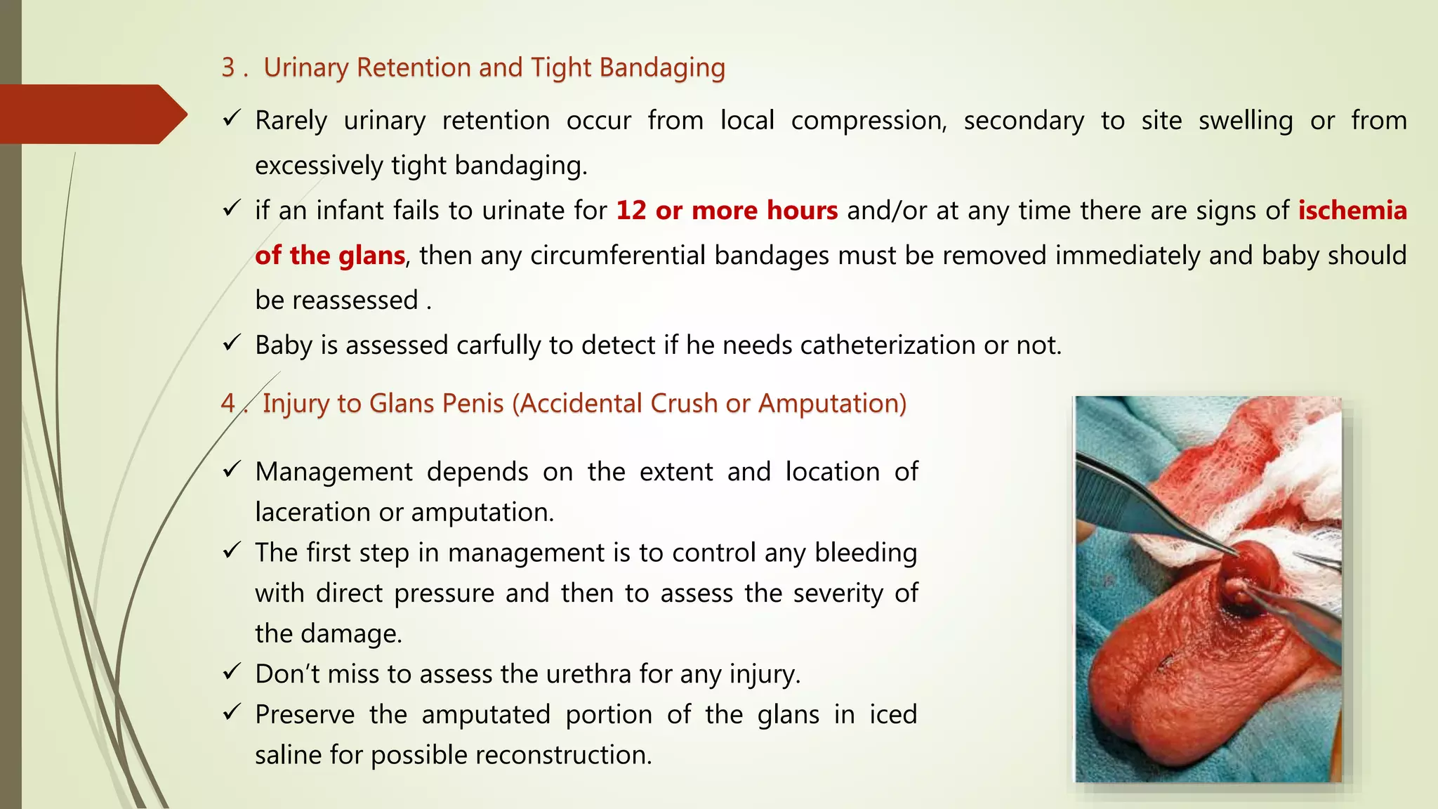 Pediatric Circumcision lecture | PPTX