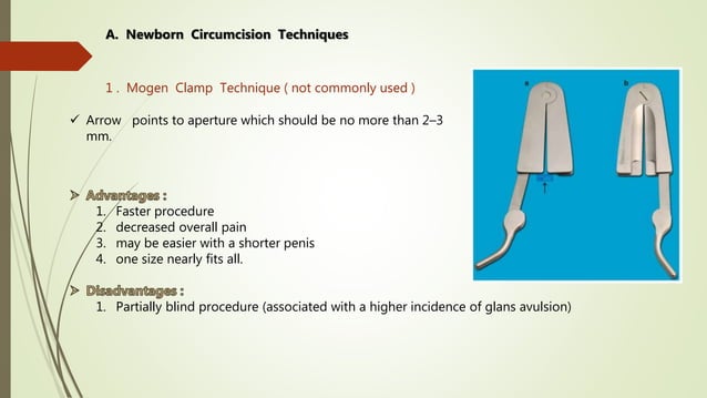 Pediatric Circumcision lecture | PPTX
