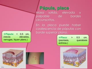 4 lesiones cutáneas primarias y secundarias | PPTX