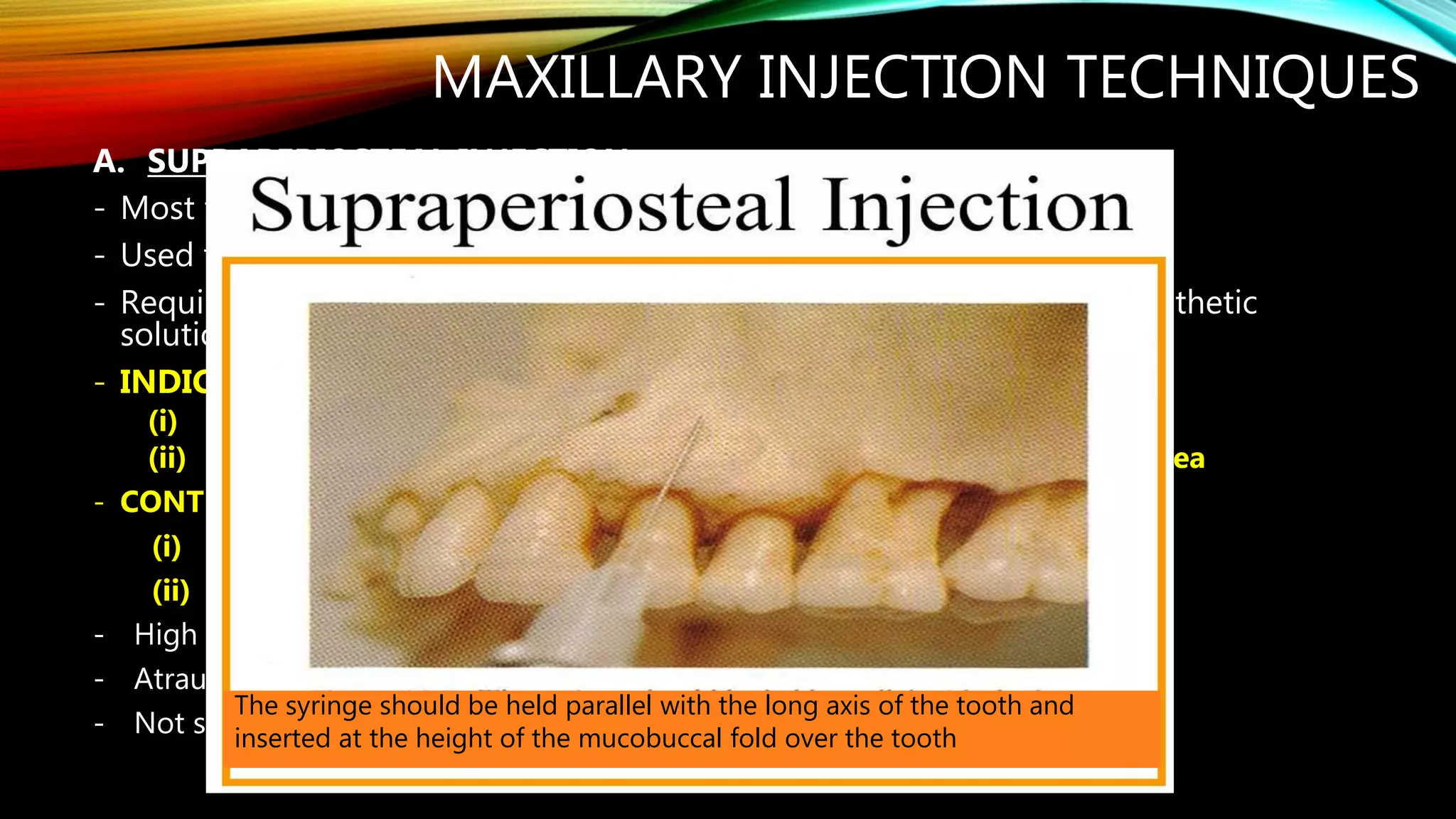 Local Anaesthesia in dentistry (Perio) | PPTX