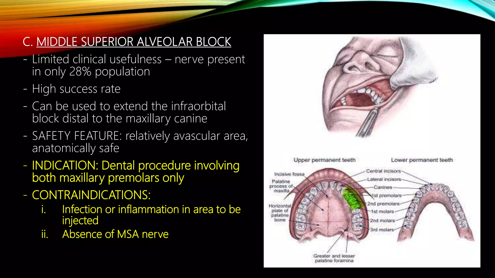 Local Anaesthesia in dentistry (Perio) | PPTX