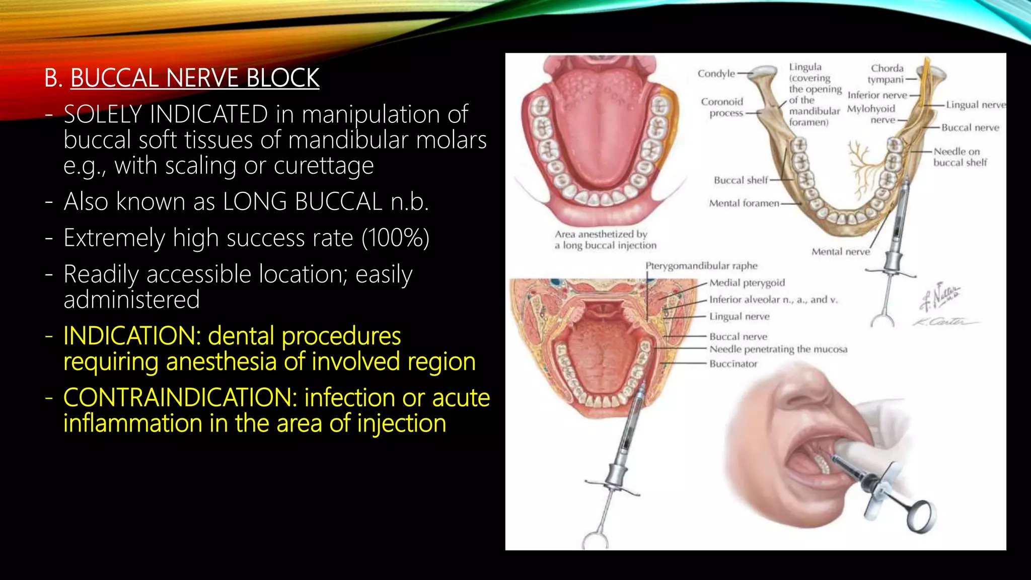 Local Anaesthesia in dentistry (Perio) | PPTX