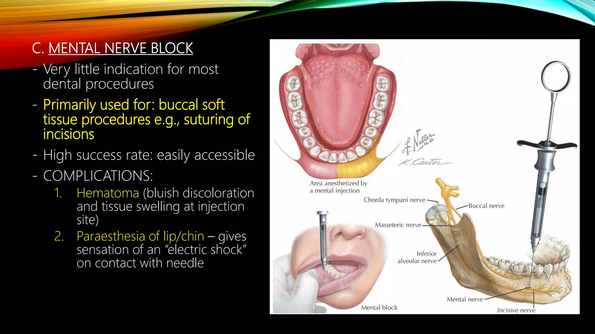 Local Anaesthesia in dentistry (Perio) | PPTX