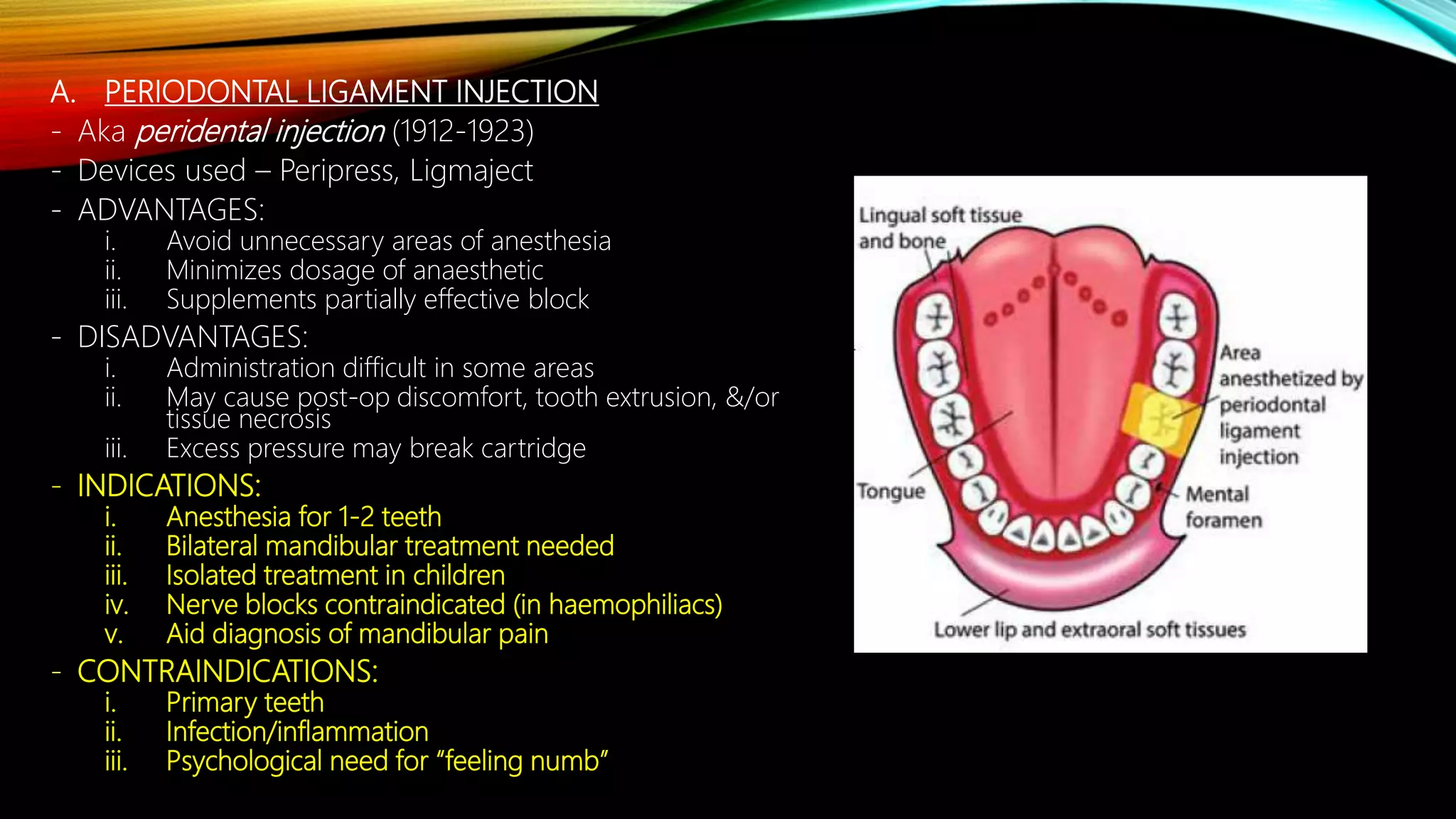 Local Anaesthesia in dentistry (Perio) | PPTX