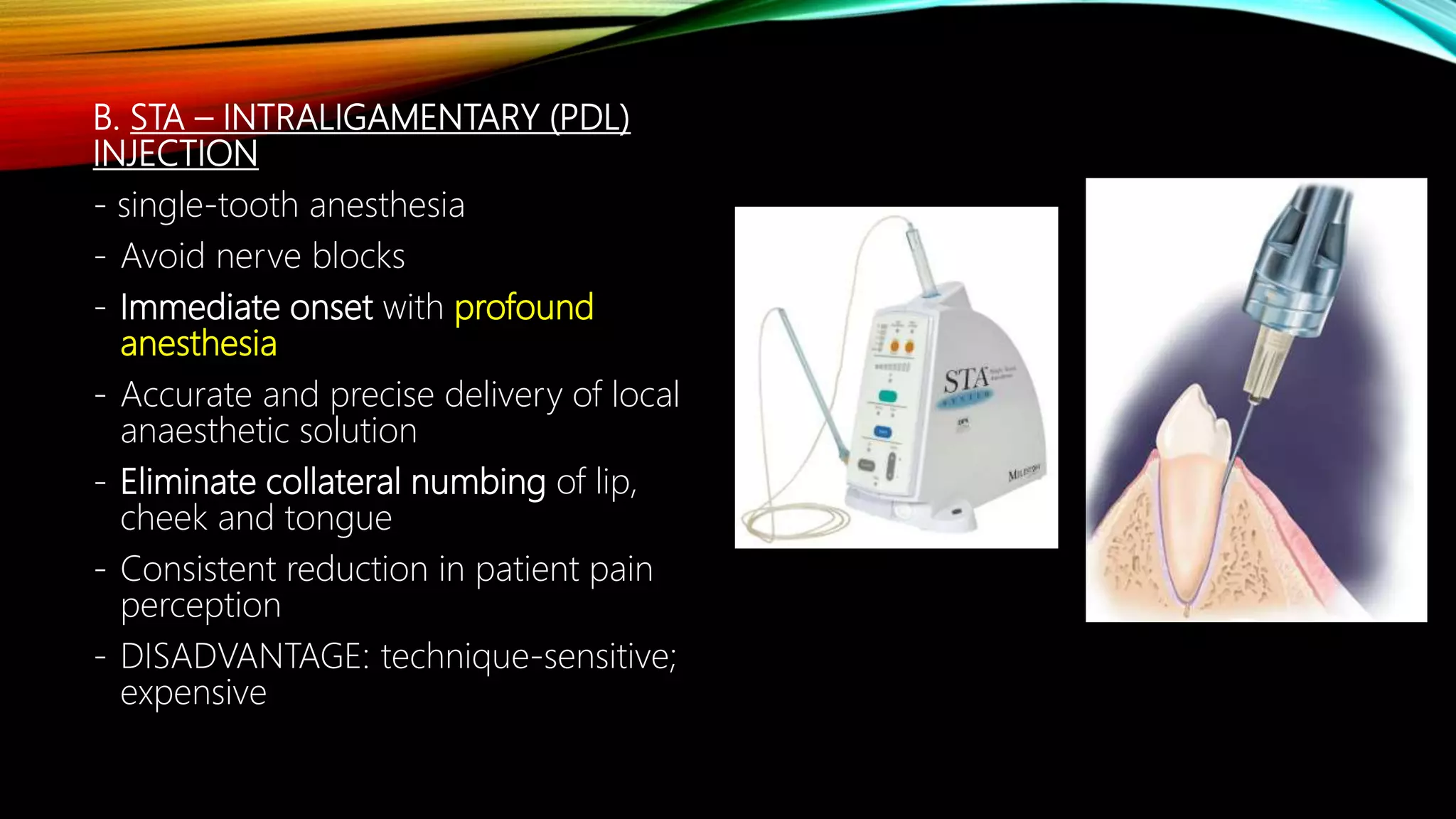 Local Anaesthesia in dentistry (Perio) | PPTX