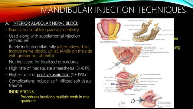Local Anaesthesia in dentistry (Perio) | PPTX