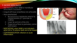 Local Anaesthesia in dentistry (Perio) | PPTX