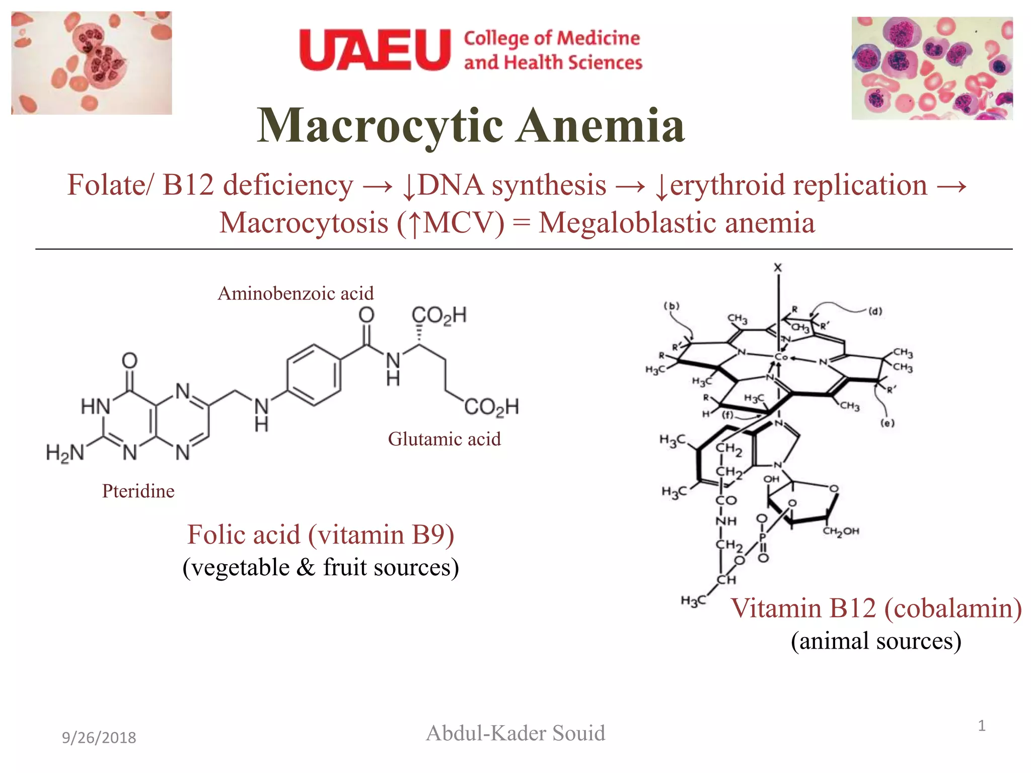 4 macrocytic anemia.ppt | Blood Disorders | Diseases and Conditions