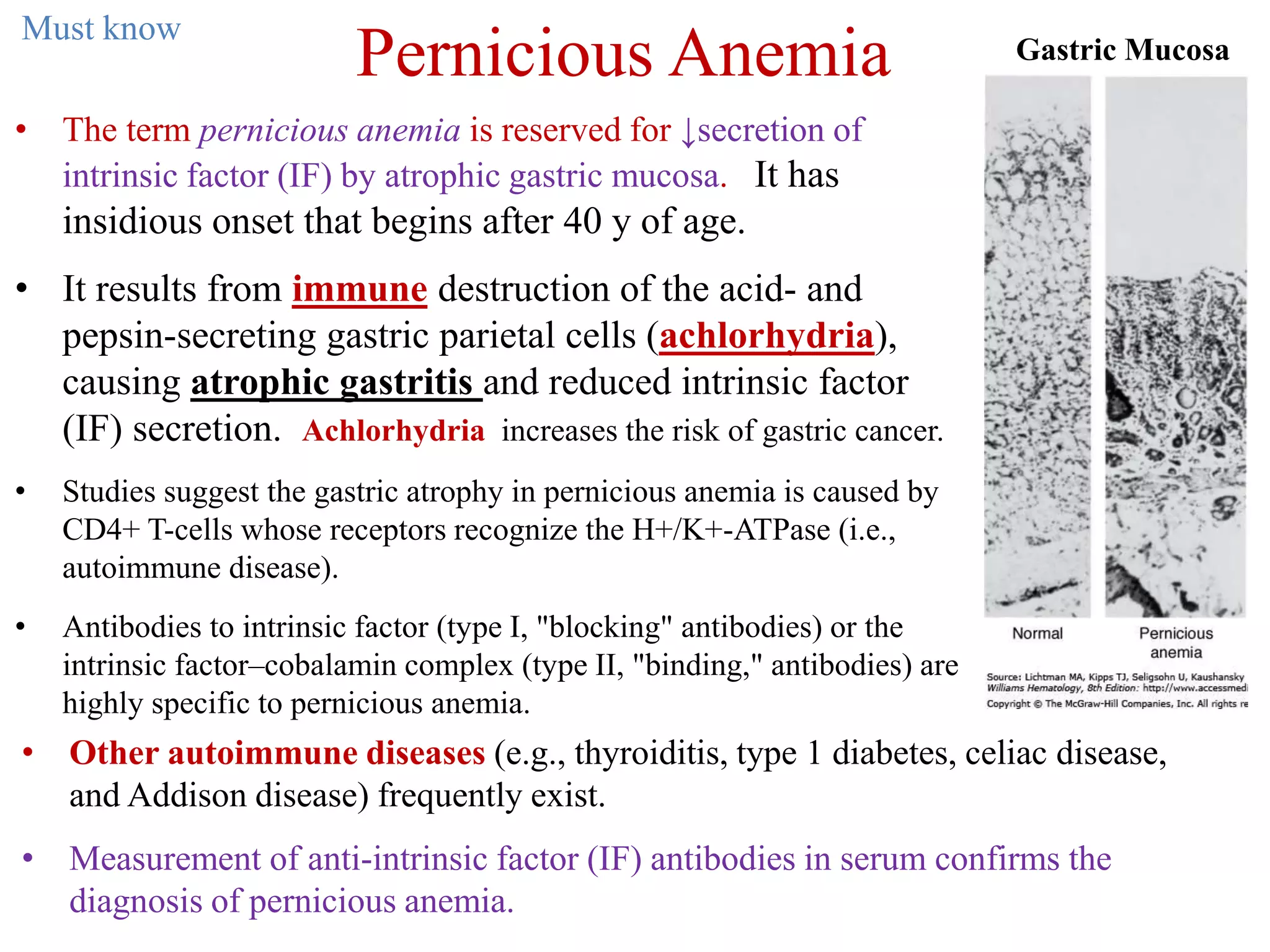 4 macrocytic anemia.ppt