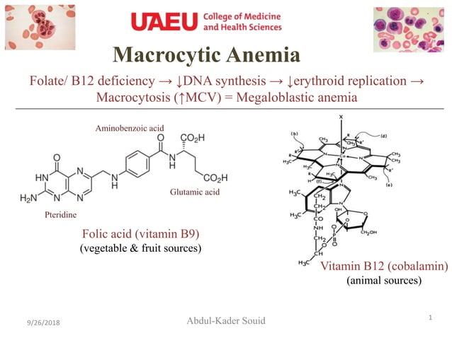 4 macrocytic anemia.ppt | Blood Disorders | Diseases and Conditions