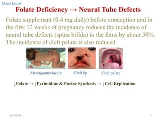 4 macrocytic anemia.ppt | Blood Disorders | Diseases and Conditions