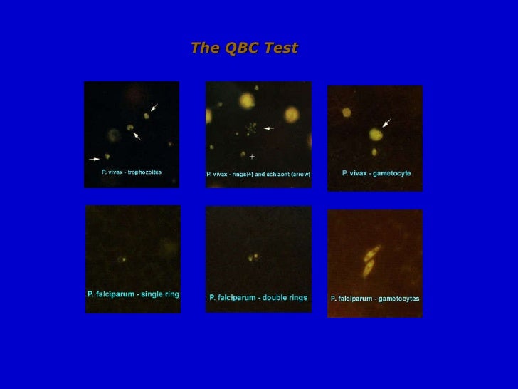 4 Malaria Diagnosis