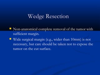 management of hepatocellular carcinoma | PPT