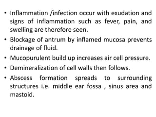 MASTOIDITIS POWERPOINT WILL HELP YOU KNOW THE MAST SITE | PPT