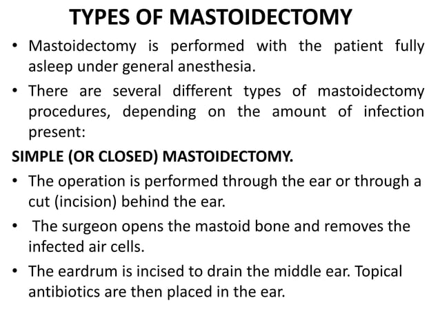 MASTOIDITIS POWERPOINT WILL HELP YOU KNOW THE MAST SITE | PPT