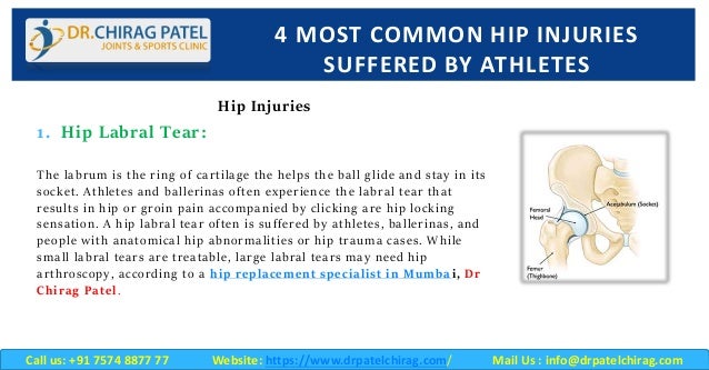 4 Most Common Hip Injuries Suffered by Athletes |Dr.Chirag Patel