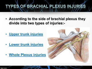 Brachial Plexus Injuries by rayan alhumaid | PPT