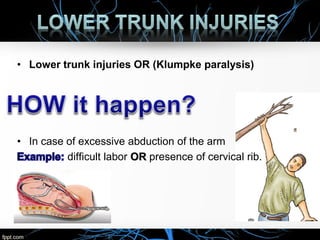 Brachial Plexus Injuries by rayan alhumaid | PPT
