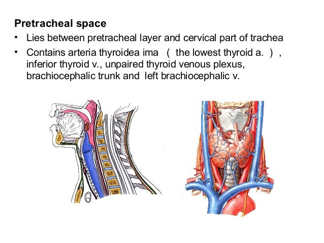 Pretracheal Space | www.picswe.net