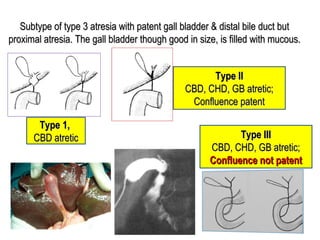 Neonatal Jaundice Ahmedabad: Dr SK Yachha | PPT