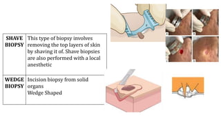 4 NEOPLASIA,BIOPSY,AUTOPSY// HISTOPATHOLOGY | PDF
