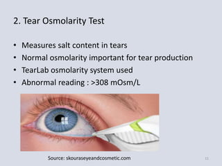 Mesenchymal stem cells to cure eye disease | PPTX