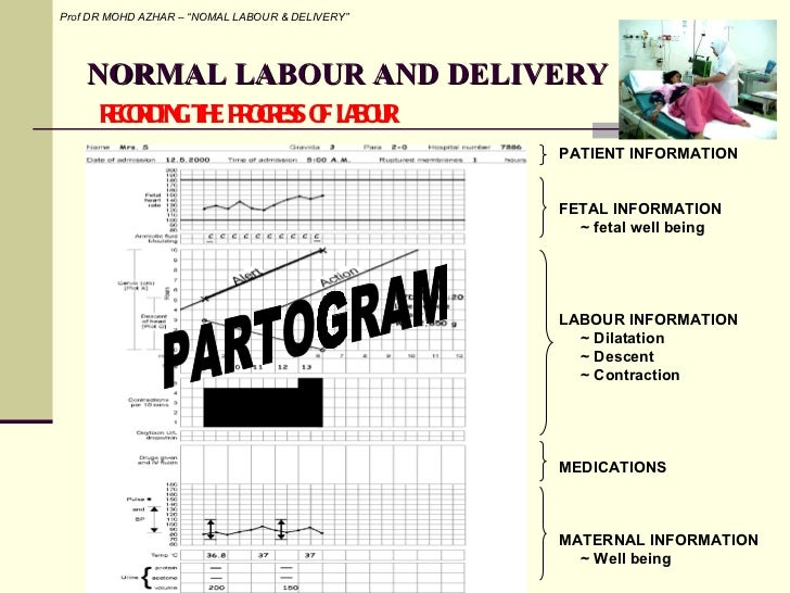 4 normal labour and delivery