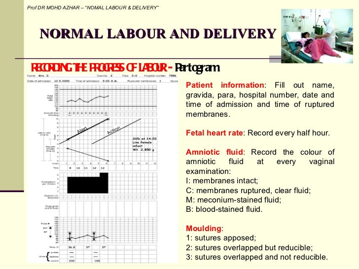 4 normal labour and delivery