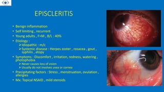 SCLERITIS presentation dhir hospital bhiwani.pptx