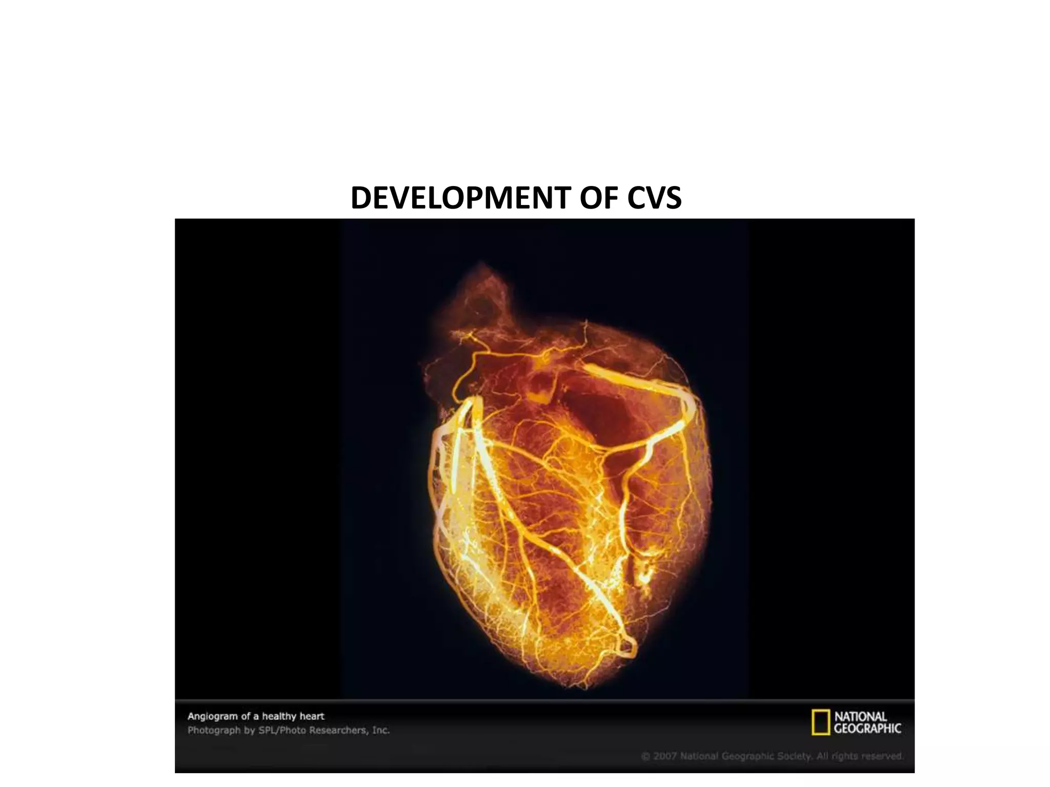 Development of heart cvs anatomy | PPTX