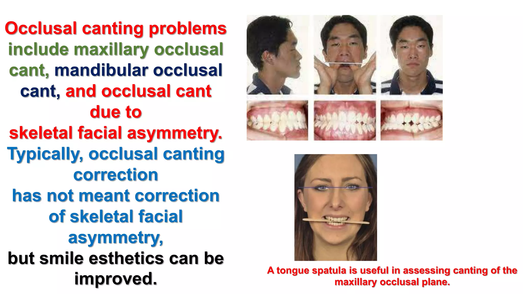 orthodontic correction of canted occlusal plane part 4 | PPTX