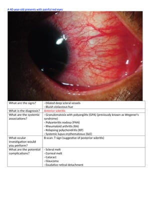 4 OSCE (Objective Structured Clinical Examination) Uveitis.docx