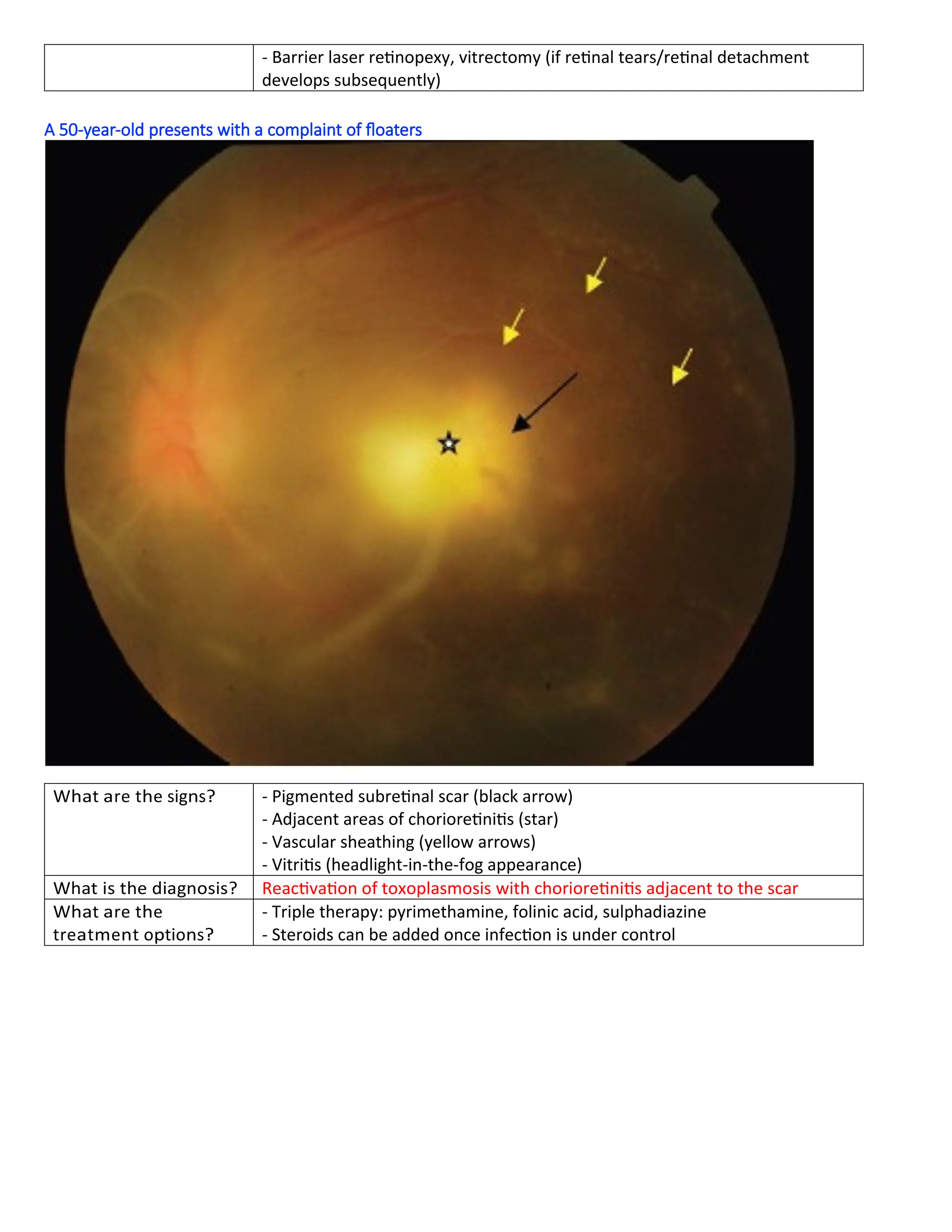 4 Objective Structured Clinical Examination in Uveitis | PDF