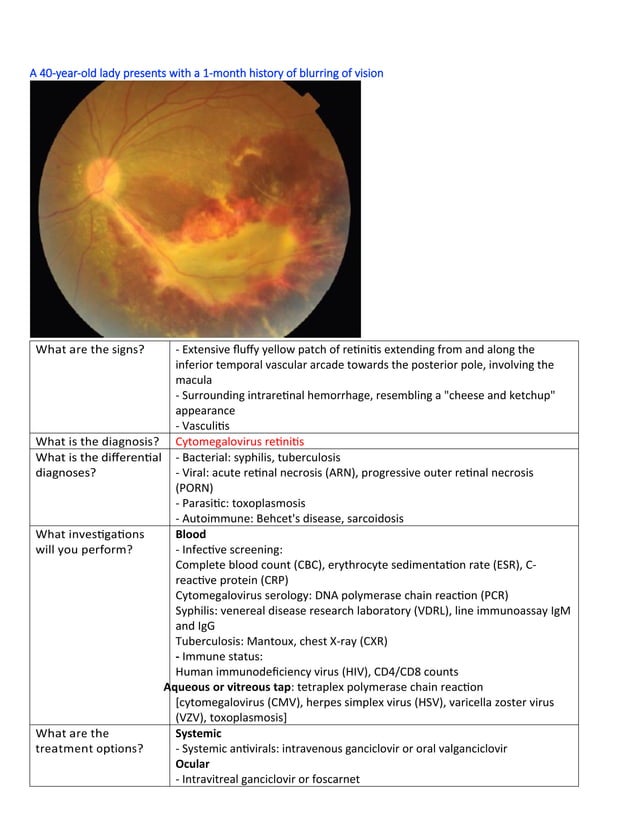 4 Objective Structured Clinical Examination in Uveitis | PDF