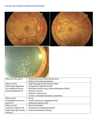 4 Objective Structured Clinical Examination in Uveitis | PDF