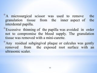 Papilla preservation flap | PPTX