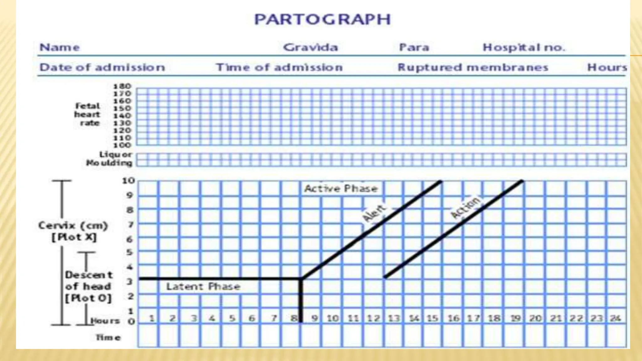 PARTOGRAM- MATERNAL AND FETAL MONITORING | PPTX