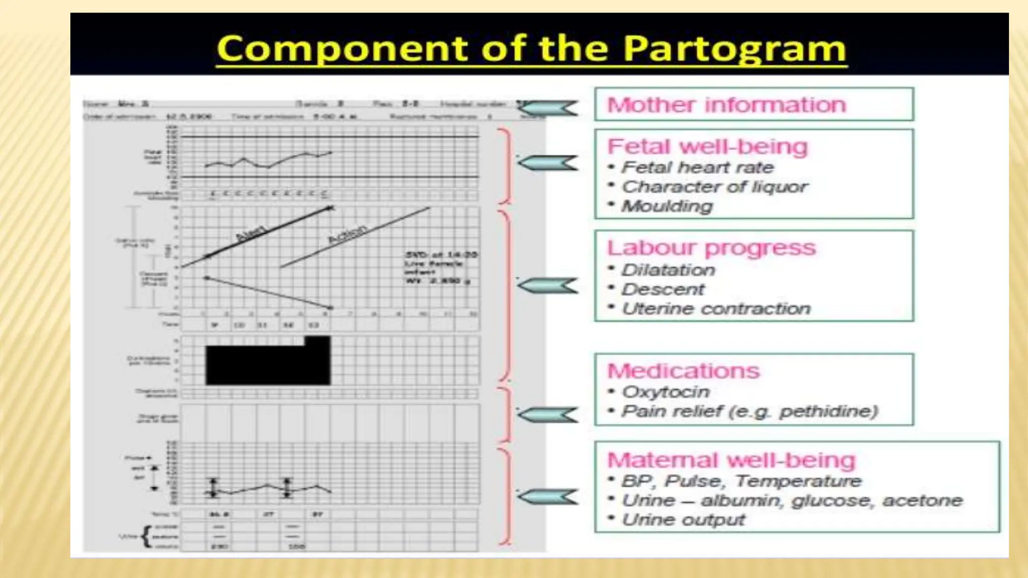 PARTOGRAM- MATERNAL AND FETAL MONITORING | PPTX