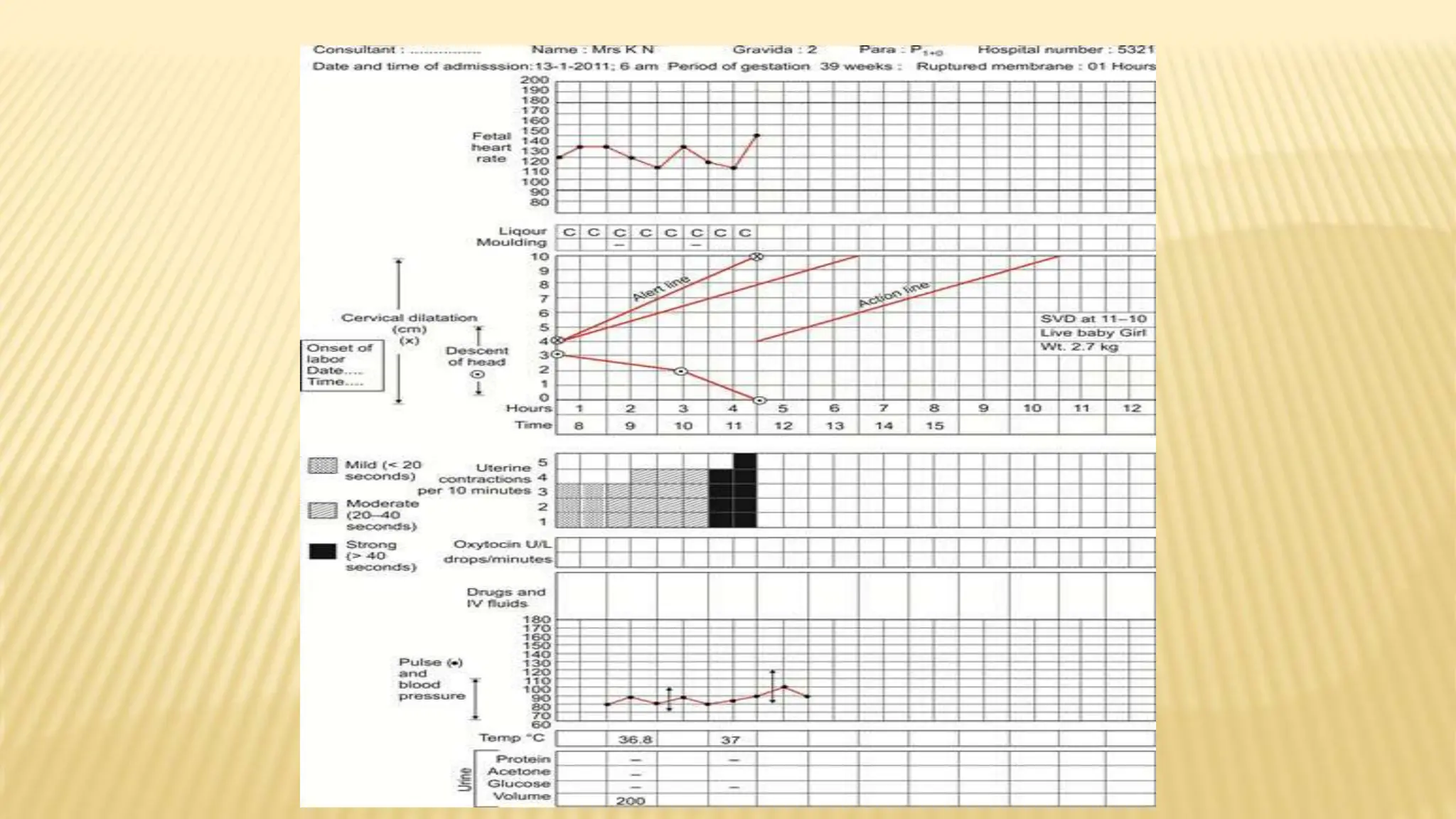 PARTOGRAM- MATERNAL AND FETAL MONITORING | PPTX