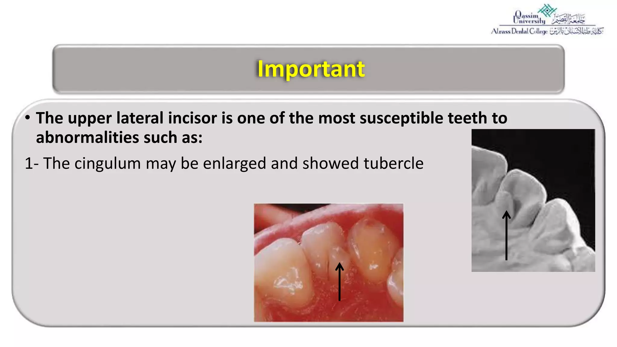 4= Permanent ‏Maxillary lateral incisor.pptx