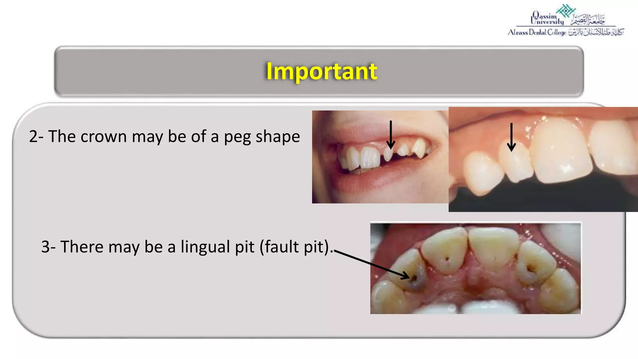 4= Permanent ‏Maxillary lateral incisor.pptx